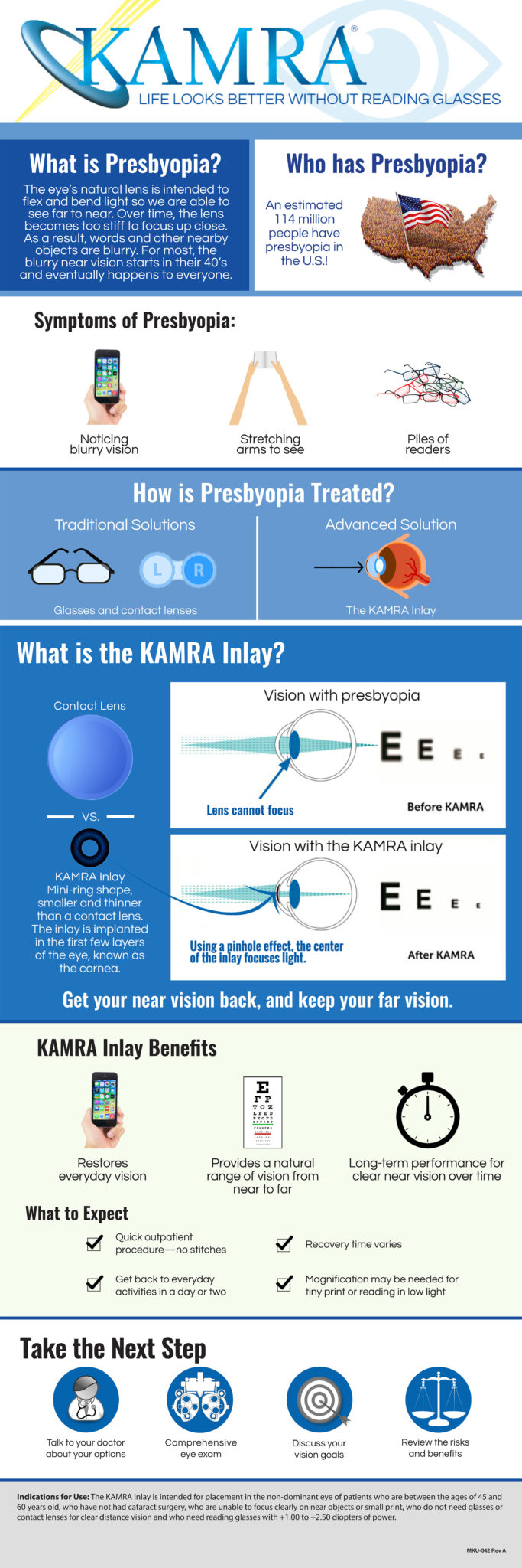 KAMRA Inlay Panama City | Near Vision Loss | The Eye Center of North ...